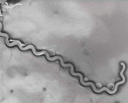 โรคฉี่หนู (Leptospirosis) - TLC Udon Lab Center