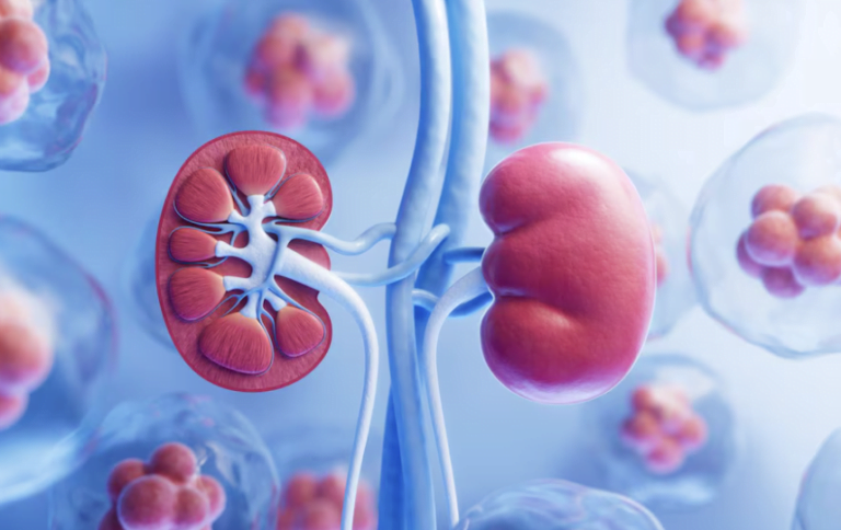 Kidney Disease: A Dangerous Threat Nearby - TLC Udon Lab Center