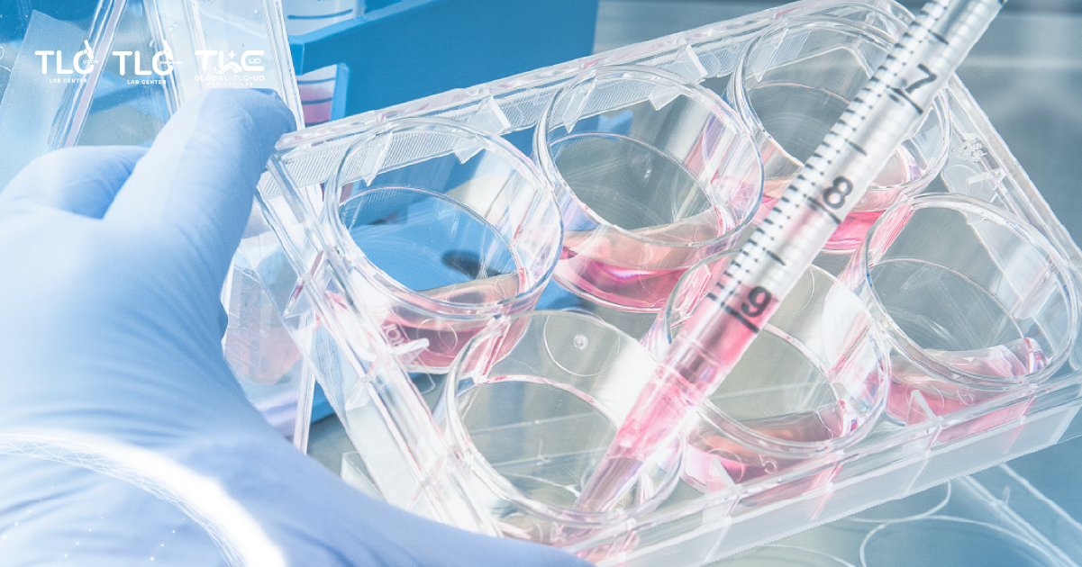 What is the tTG-IgA test used for? - TLC Udon Lab Center